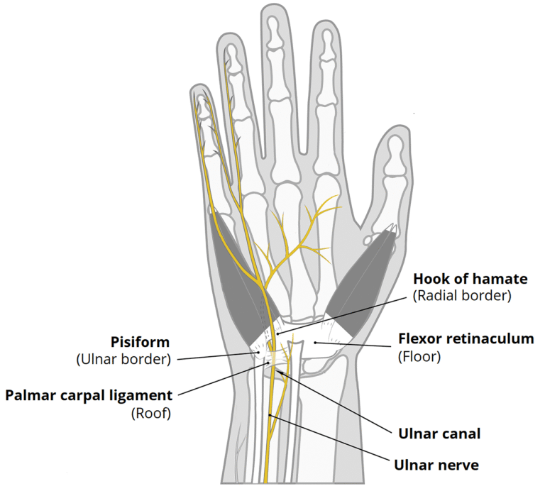 Guyon’s canal (ulnar nerve) release - Dr. Anton Lambers – Orthopaedic ...