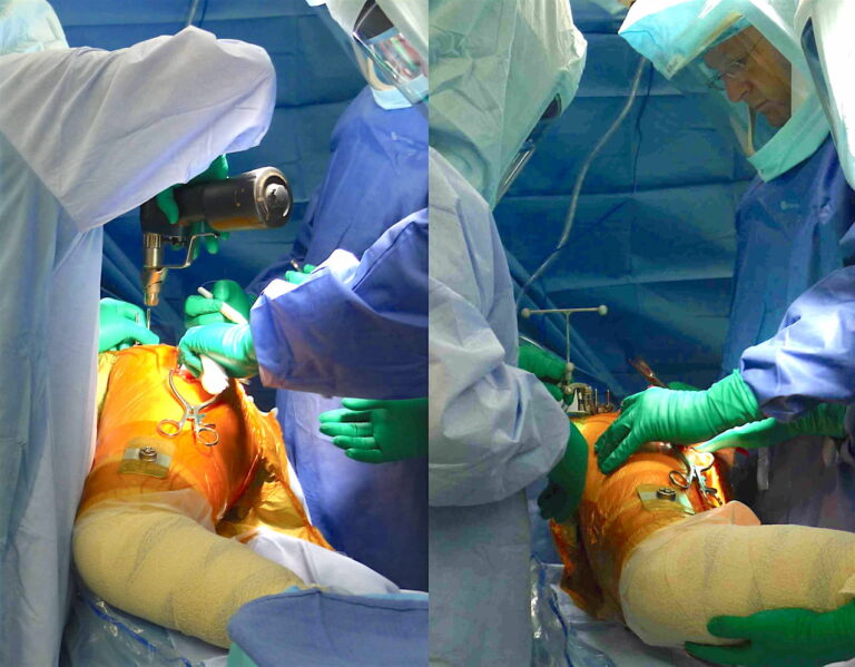 Do Hip Pins Hurt? - Dr. Anton Lambers – Orthopaedic Surgeon in Bright