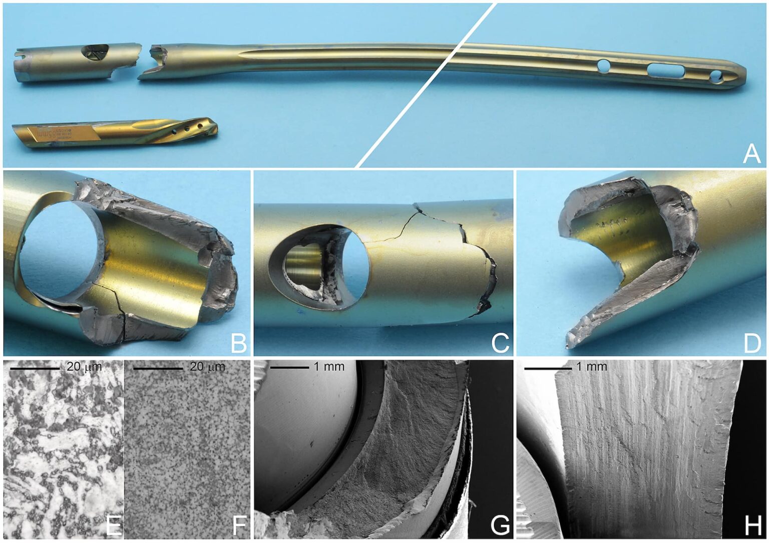 Hip Fracture Implant Lab Analysis - Dr. Anton Lambers – Orthopaedic ...